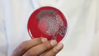 Group A Strep and Group B Strep - Group B Strep Support